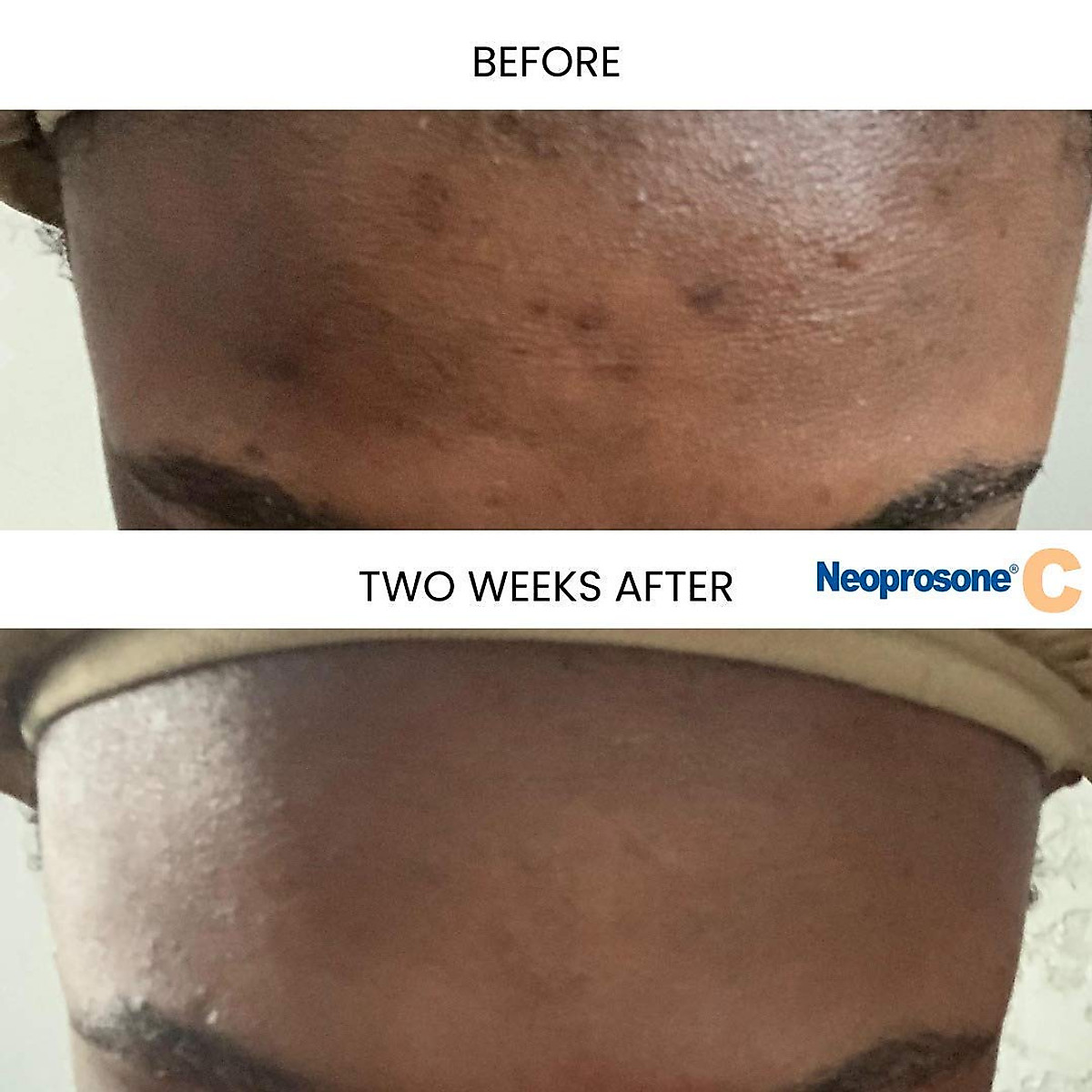 Neoprosone, Vitamin C Serum for Face | 1 Fl oz / 30ml | Brightening Serum For Dark Circle, Wrinkles | with Alpha Arbutin and Castor Oil