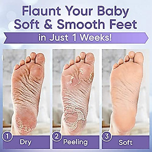 Foot Peel Mask, YOUPINWEI Exfoliating Feet Peeling Mask for Dry Cracked Heels - 2+1 Packs - Make Your Feet Baby Soft Get Smooth Silky Skin, Calluses and Dead Skin Remover for Women and Men