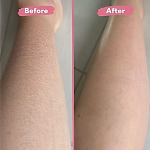 PEACHYGLO Deep Exfoliating Glove for Body 2pc - Shower Scrubbing Mitt for Softer Illuminate Skin, Dead Skin Remover for Women, Silky Smooth Skin