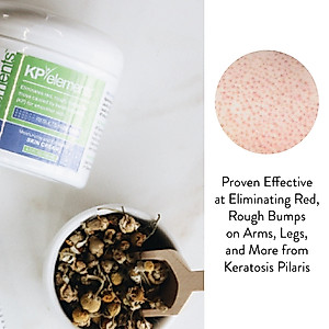 KP Elements Keratosis Pilaris Lotion (4 fl oz) - Natural Keratosis Pilaris Treatment, Moisturizing & Exfoliating AHA Lotion for KP, Vegan, Made in USA