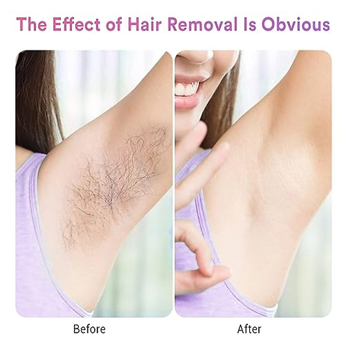 ONE BEAUTY IPL Hair Removal for Women and Men, Ice-Cooling, Ice Painless Laser Hair Removal, FDA Cleared, Permanent Hair Removal Device for Facial Whole Body, 999999 Flashes Hair Remover with 5 Modes