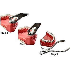 Molar Band Remover pliers band removing pliers Orthodontic Braces Removal Tool Dental ARTMAN brand by Wise Linkers