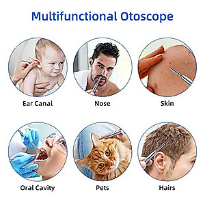 Cainda Otoscope USB Ear Camera, Ear Wax Removal Endoscope with Light for Android Phone Window and Mac PC (Not for iPhone), Digital USB Camera with Ear Cleaning Earwax Removal Tool