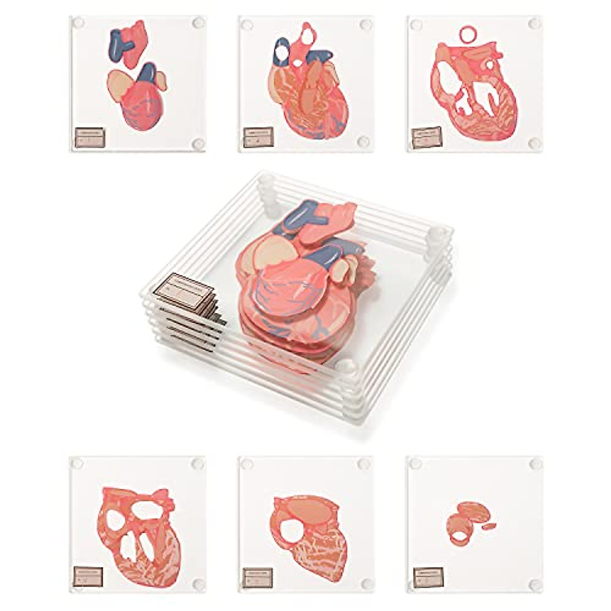 Anatomic Heart Specimen Coasters (Set of 6) - 3D Brain Coaster Set Also Available. Human Anatomy Gifts Medical Student Gifts CNA Gifts for Women Best Gifts for Medical Students Thinkgeek Coasters