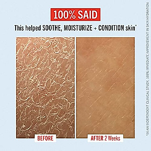 First Aid Beauty Ultra Repair Cream Intense Hydration Moisturizer for Face and Body – 6 oz.