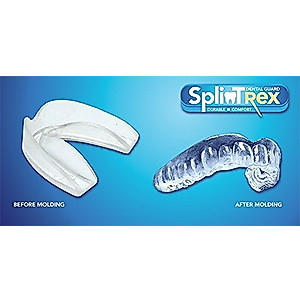 SplinTrex Multi Use Teeth Mouth Guards - 4 Pack - BPA Free - Teeth Grinding Dental Night Guard, Athletic Mouth Guard, Teeth Whitening Tray - Includes 4 Customizable Mouth Guards and Storage Case