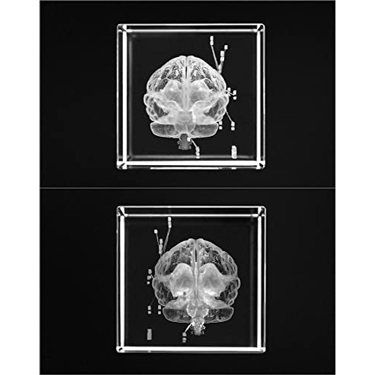 QWORK 3D Human Brain Anatomical Model, Laser Etching Crystal Glass Cube Science Gift Paperweight (LED Base not Included), 3.1(L) x2(W) x2(H) inches