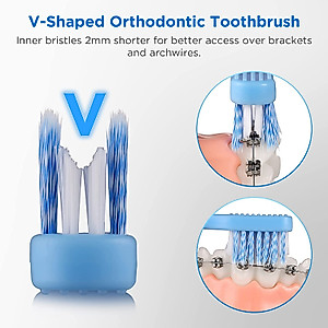 Fremouth V-Shaped Orthodontic Toothbrush for Braces, Soft Bristles, 6 Count, with Interdental Brushes