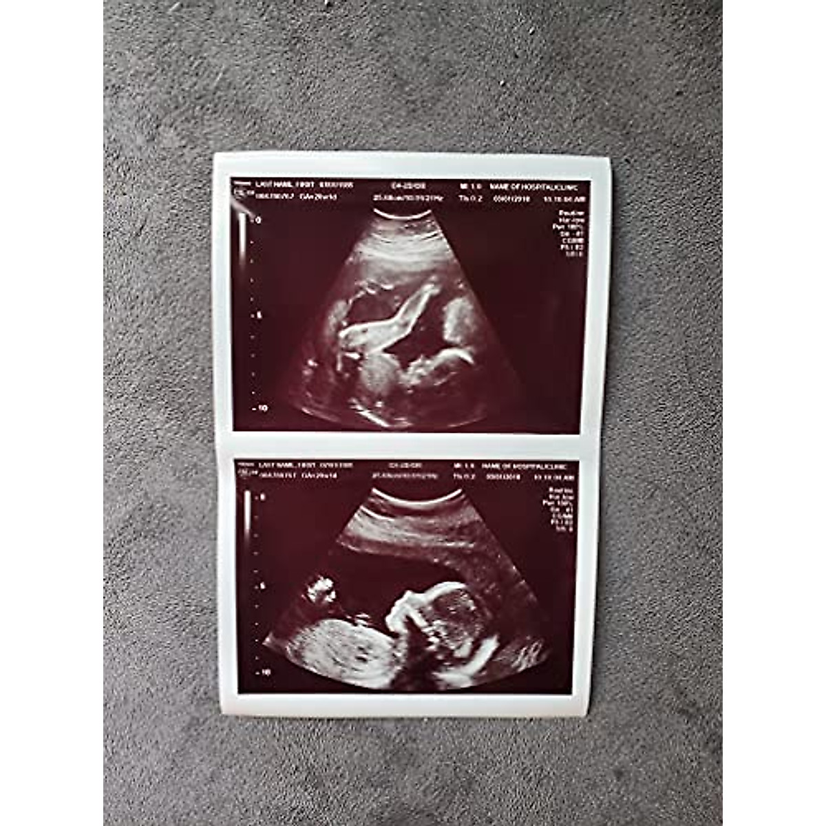 Prank 2D Customized Fake Ultrasound TWO PHOTOS Connected B&W
