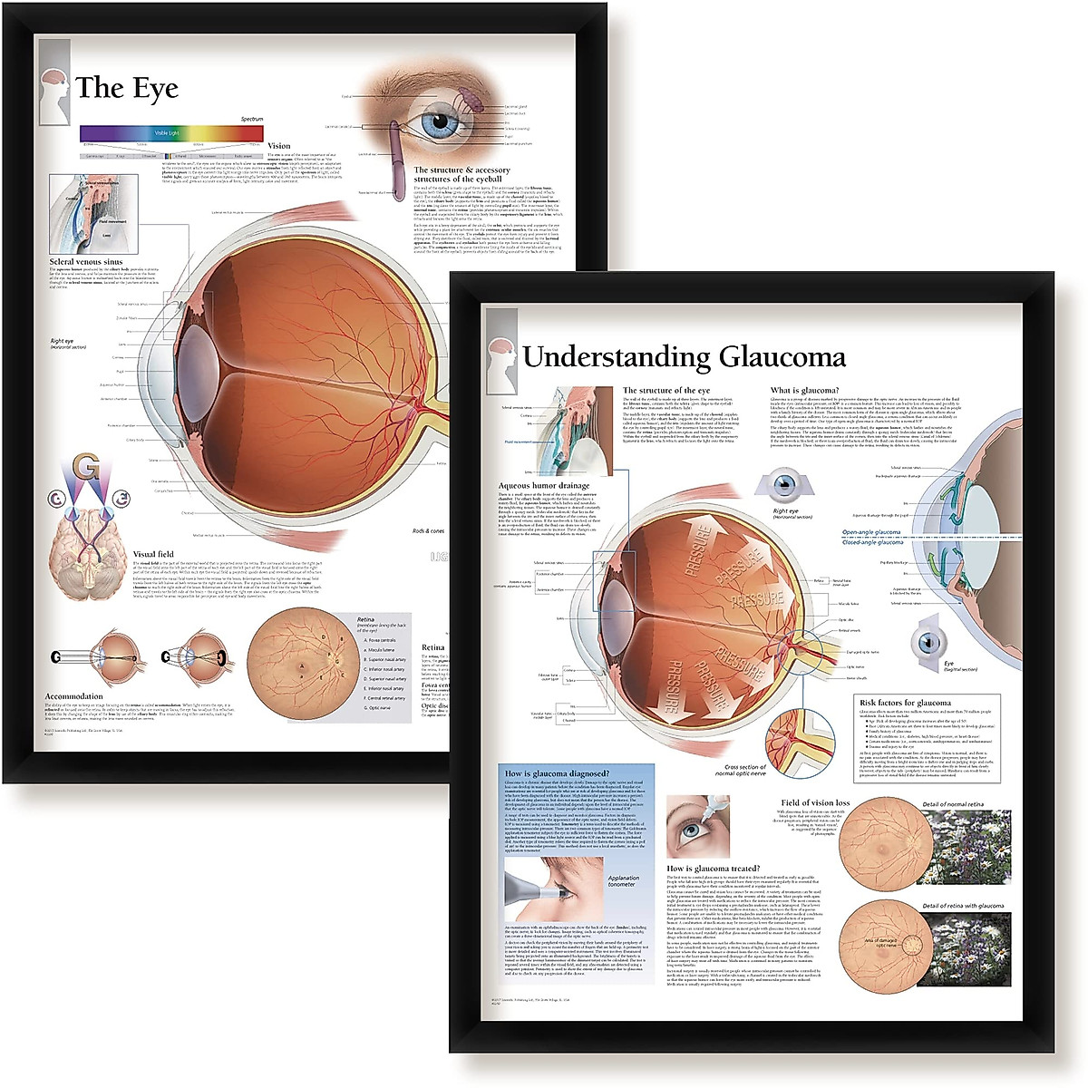 Set of 2 Framed Medical Posters The Eye and Understanding Glaucoma 22"x28" Wall Diagrams