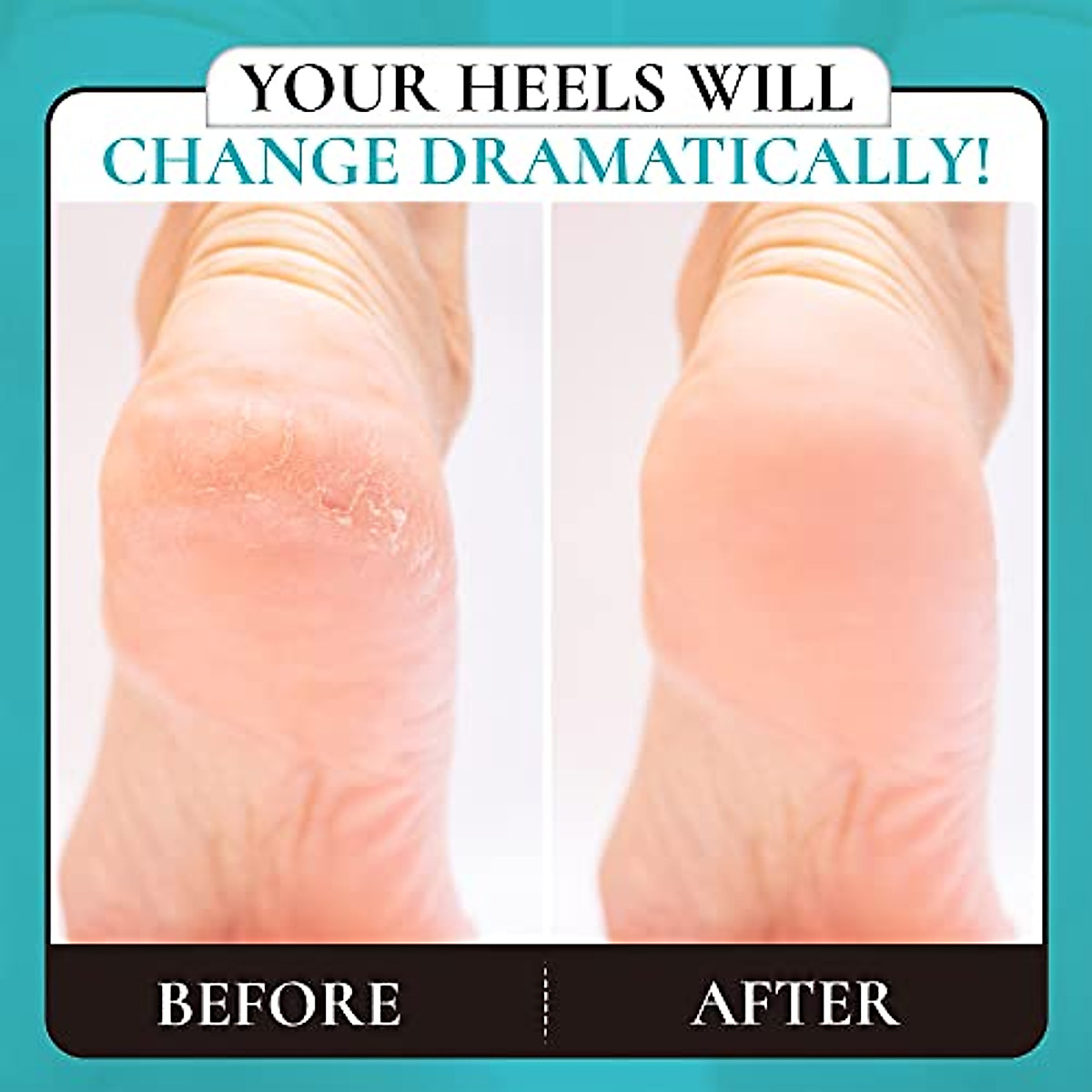 aogi Foot rasp Pedicure Foot File - Removes Damaged and Hard Skin, Avoids Callus Buildup – Gentle, Fine File for at-Home Professional Treatment (Black, Waterproof, Comes with Original Pouch)