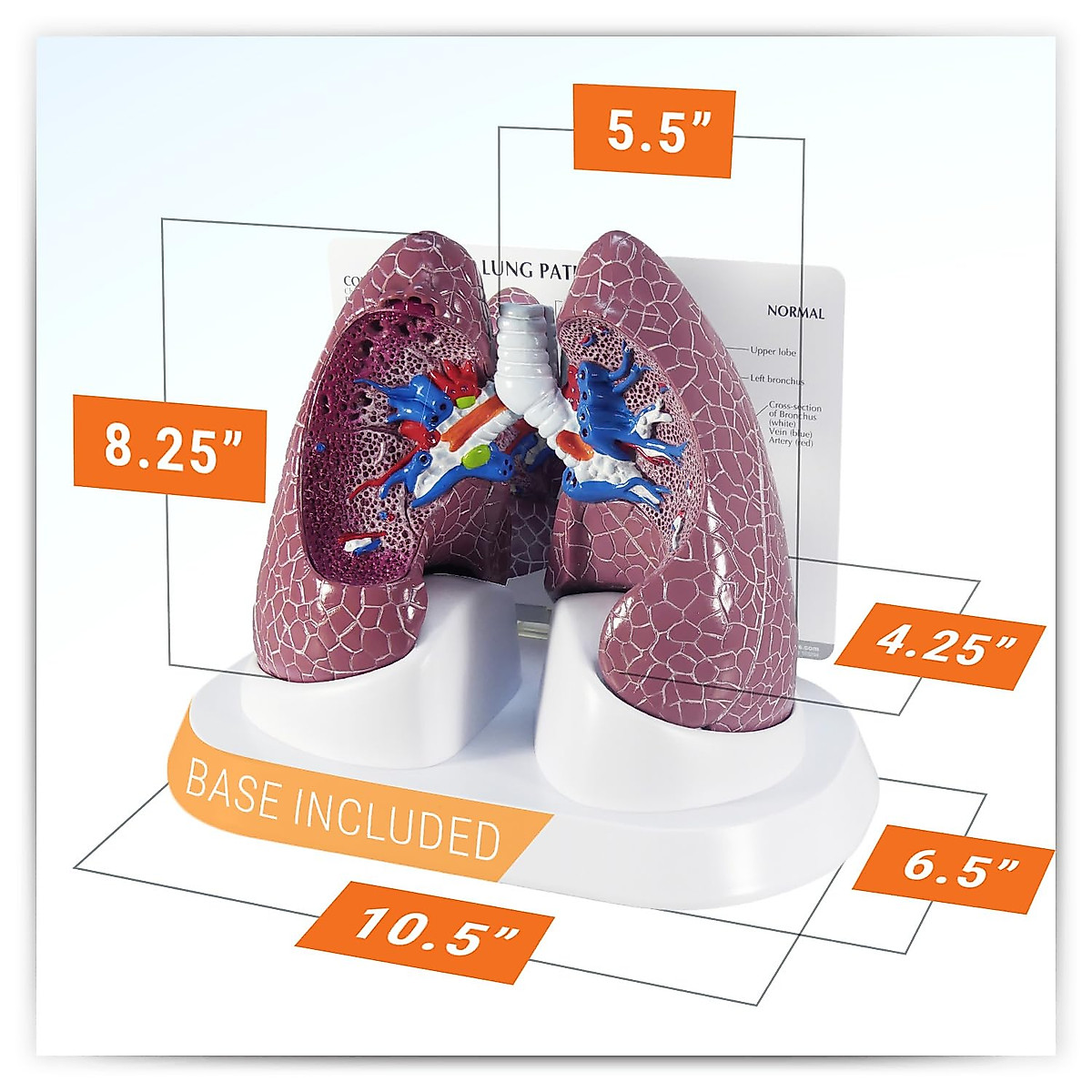 Lung Model Set | Human Body Anatomy Replica of Lung Cancer for Doctors Office Educational Tool | GPI Anatomicals