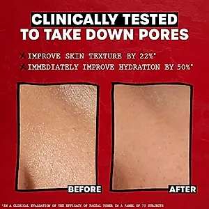 THAYERS Alcohol-Free, Hydrating, Unscented Witch Hazel Facial Toner with Aloe Vera Formula, Vegan, Dermatologist Tested and Recommended, 12 Oz (Packaging May Vary)