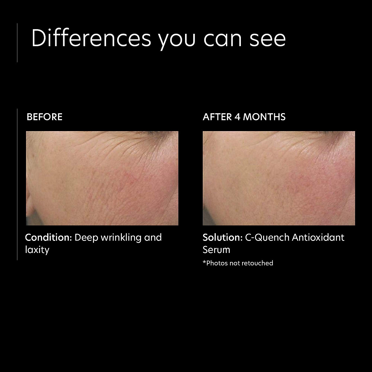 PCA SKIN Vitamin C Quench Antioxidant Protective Face Serum - Anti Aging Hydrating Facial Corrector with Hyaluronic Acid for Fine Lines & Wrinkles, Recommended for Oily & Acne-Prone Skin (1 fl oz)