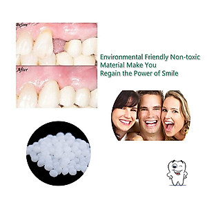 Multi-functional Temporary Tooth Repair Kit Moldable Thermal Fitting Beads for Snap On Instant and Confident Smile Denture Adhesive Fake Teeth Cosmetic Braces Veneer
