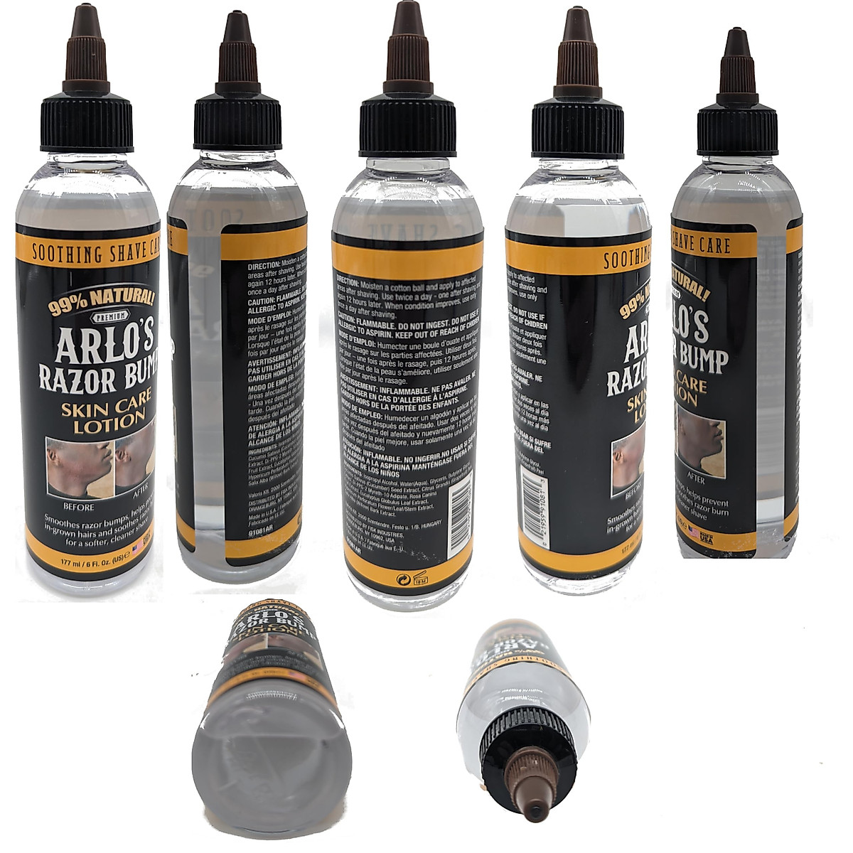 Arlo's Razor Bump Skin Care Lotion 6 oz.