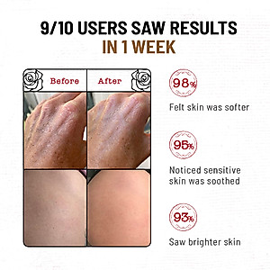 Coffee Body Scrub, Exfoliating Body Scrub, Arabica Coffee with Vitamin E Coffee Scrub, Dead Skin Body Scrubs for Women Exfoliation, Skin Care for Cellulite, Acne & Stretch Marks