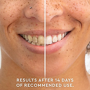 MOON Teeth Whitening Pen, Brush Every Tooth White, On-The-Go Whitener for A Brighter Smile, Gentle on Sensitive Teeth, 30+ Uses, Vegan, Vanilla Mint Flavor