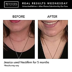 Revision Skincare Nectifirm (Packaging may vary), No Color, 1.7 Oz