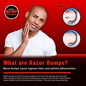 Bump Stopper 2 Double Strength Razor Bump Treatment | Formulated to Relieve Razor Burn | Eliminates Ingrown Hairs | Aftershave For Men - 0.5 OZ