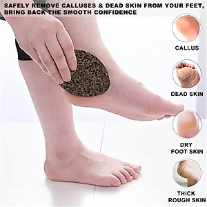 ICANdOIT Natural Brown Earth Lava Pumice Stone, Pedicure Exfoliation Tool,Callus Remover for Feet Heels and Palm,Corn Remover,Dry Dead Skin Scrubber,Health Foot Care,Dry&Wet Use,Pack of 1