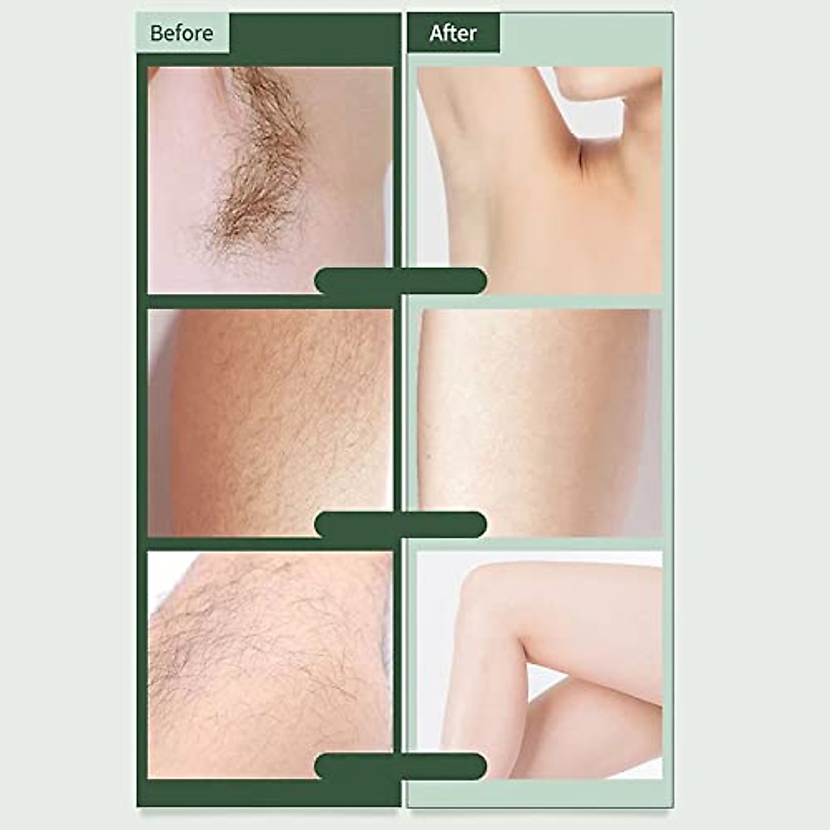 Arsor Bikini Trimmer, Portable Dry Use Electric Razor Angled Fit Smooth & Silky Bikini Kit LED Light Personal Groomer with Limiting Comb Bikini Shaver for Women Pubic Hair Bikini