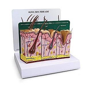 GPI Anatomicals - Aging Skin/Hair Loss Model | Human Body Anatomy Replica of Aging Skin w/Hair Loss for Dermatology Educational Tool