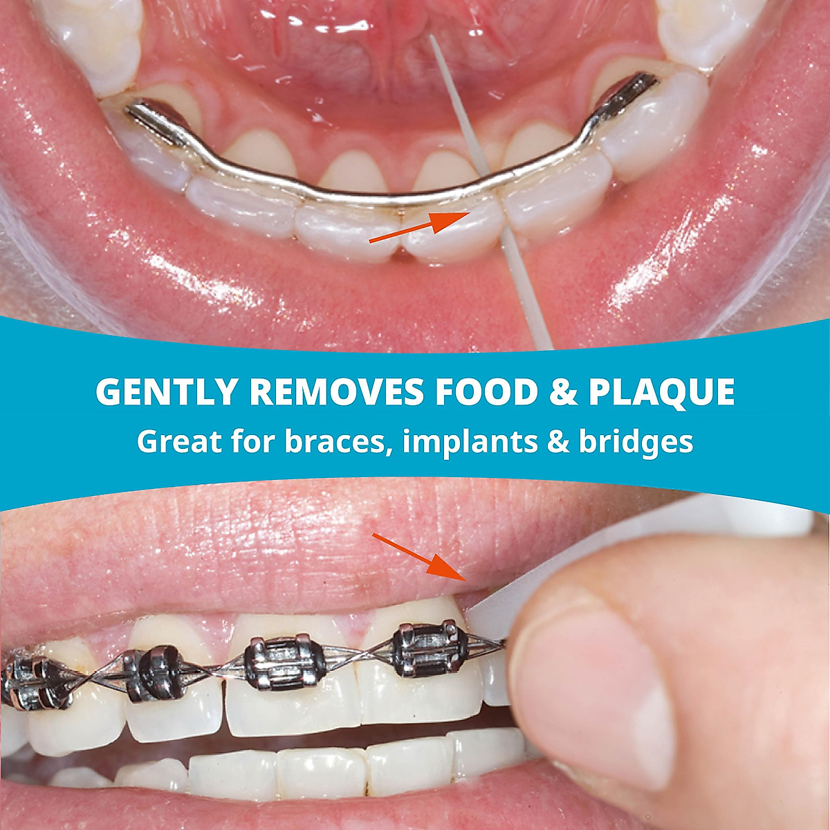 ULTRADENT Opalpix Dental Picks (1 Pack) 32ct per Pack Toothpicks Opalescence Teeth Floss Products Plastic Tooth Dental Pick Oral Care Soft Gum 5590-1