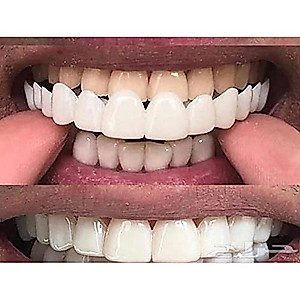 New Silicone Gel Smile Upper and Lower Cosmetic Teeth Tooth Cover Perfect Smile Veneers Comfort Fit Flex molds Mold Denture Braces