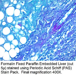 Periodic Acid Schiff (PAS) Stain Pack, 1000ml