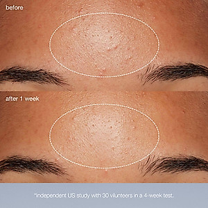 Dermalogica Daily Microfoliant, Face Exfoliator Scrub Powder with Salicylic Acid and Papaya Enzyme, Achieve Brighter, Smoother Skin Daily, Refill Pack, 2.6 Oz