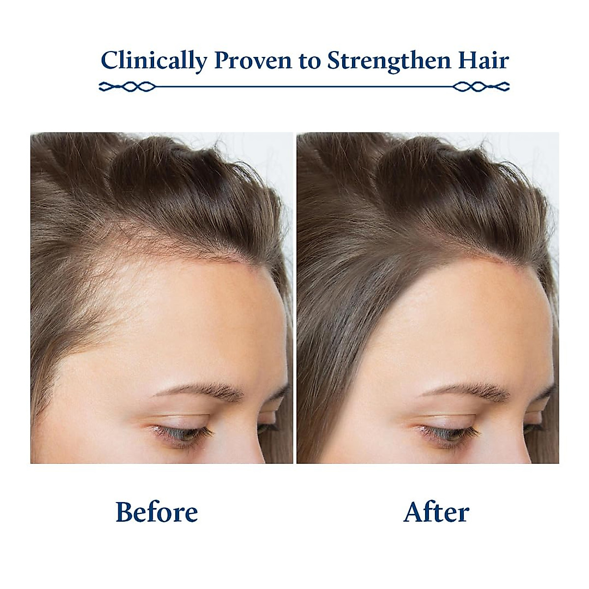 Blue Nectar Anti Hair Fall Shampoo with Amla, Honey and Mulethi, Paraben and Sulfate Free Shampoo for Women and Men Natural Hair Shampoo for Thick Hair (10 Herbs, 6.76 Fl oz)