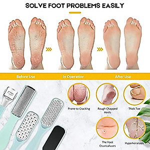 Pedicure Foot File Tools Kit - Professional Feet Corns Callus Remover Shaver Hard Dead Skin Removal Double-sided Home Professional Wet Dry Use Best Gift for Family Friends Men Women Foot Care Set