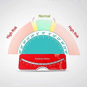 FROON Scoliosis Portable Medical Evaluation,Back Spine Scoliosis Measuring Tool ，Testing Meter Scoliosis Test Gauge for Diagnosis of Back and Spine Scoliosis in Adults or Children (Green)