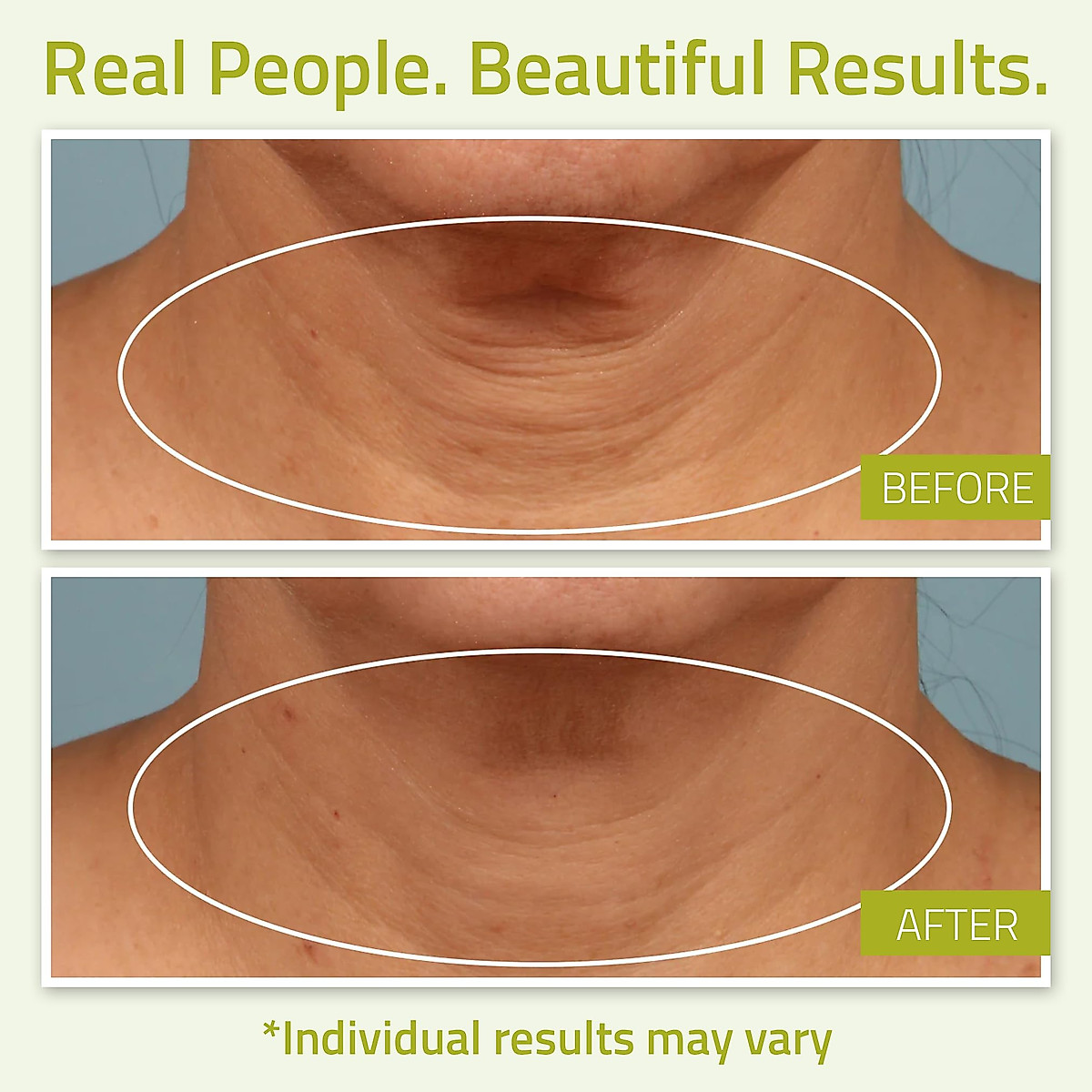 YEOUTH Neck Cream with Vitamin C, Moisturizing Neck Firming Cream for Women and Men, Targeting Decolletage and Double Chin, Cleavage and Chest 2oz