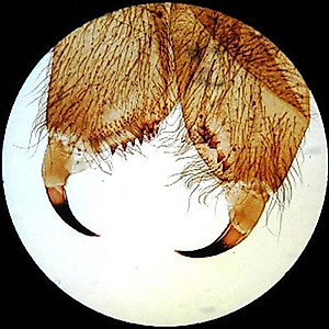 AmScope PS100A Prepared Microscope Slide Set for Basic Biological Science Education, 100 Slides, Set A, Includes Fitted Wooden Case