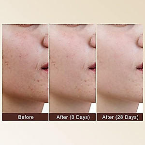 Forest Cabin Camellia Repair Essence Oil for Face, Anti Aging Serum, Promote Cell Autophagy Serum for Fine Lines and Wrinkles, 30ml