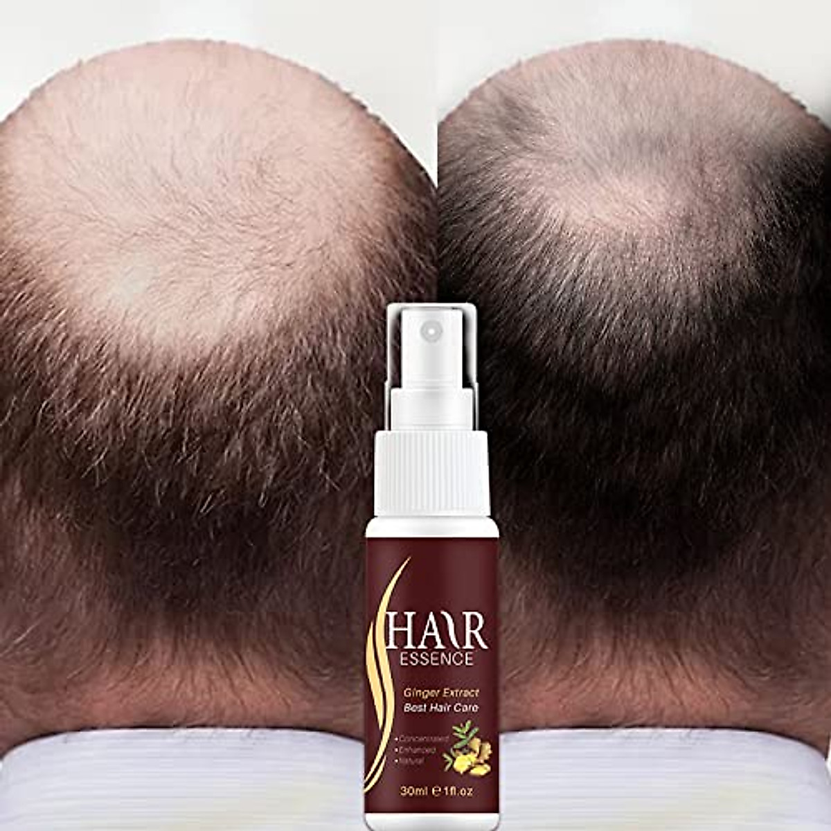 Korean Face Roller Hair Spray Hair Growth Oil Hair Growth Thicker Fuller Healthier Hair Hair Loss And Thinning Women And Men 30ml for Skin Care