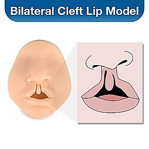 Ultrassist Bilateral Cleft Lip Model, Cleft Lip Suture Training Simulator for Medical Students, Education, Display