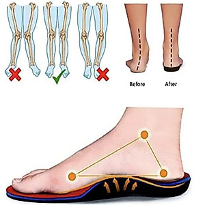 AODGHC Women's Orthopedic Sneakers, Orthopedic Walking Shoes for Women, Comfortable Air Cushion Orthopedic Sneakers, Orthopedic Slip On Shoes for Women (US 8,Black)