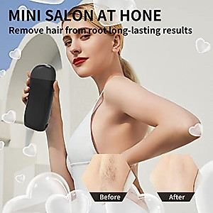 Roll on Wax Kit, Wax Roller Kit, Roll on Wax Warmer for Hair Removal, Roll on Wax for Larger Areas of the Body, At Home Waxing Kit for Women and Men