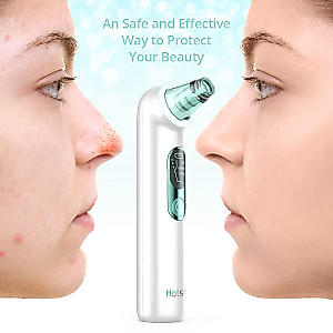 Blackhead Remover Pore Vacuum - Hotsch Blackhead Removal Tool, Pore Cleaner Electric Acne Extractor Kit, LED Display USB Rechargeable with Upgraded Blue Light 4 Replaceable Suction Probes