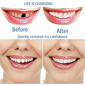 Fake Teeth,Daily Tooth Repair Kit,False Teeth For Veneers Teeth Men Beads Braces Cover Imperfect Teeth,Denture Repair Kit Cover Missing Teeth Snapon Smile,Veneers Teeth For Women Men Dental Repair Kit