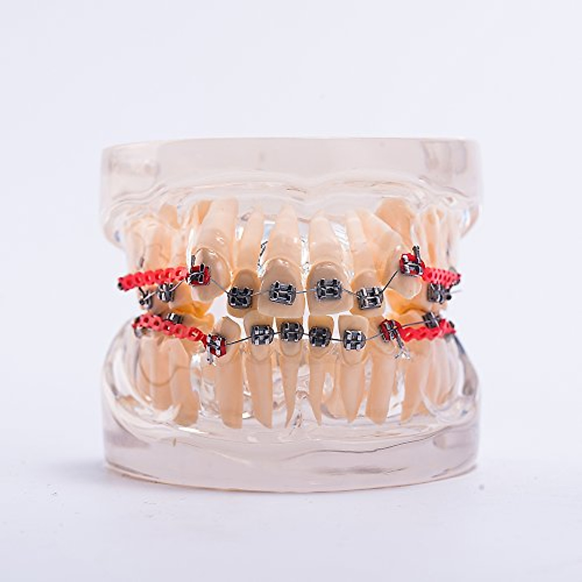 Easyinsmile Dental Orthodontic Treatment Model Teeth/Tooth/Denture Model with Braces for Dentist Studying Researching and Patient Education (Metal Bracket)