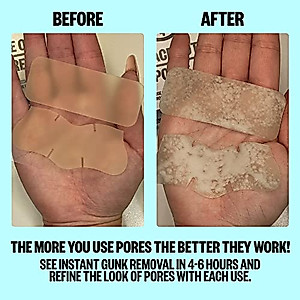 PEACE OUT Skincare Pores. Hydrocolloid Pore-Refining Nose and Face Strips with Vitamin A to Shrink Enlarged Pores and Remove Excess Oil (4 pore and 4 nose strips)
