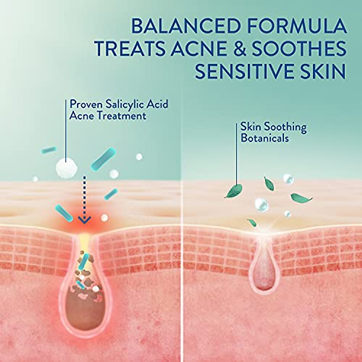 Cetaphil Face Moisturizer, Gentle Clear Mattifying Acne Moisturizer With 0.5% Salicylic Acid, Hydrates and Treats Sensitive Acne Prone Skin, Skin Care for Sensitive Skin, 3oz