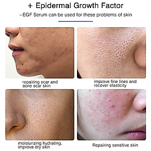 EGF Skin Rejuvenation Serum & Epidermal Growth Factor Powder Kit, Moisturizing Removing Wrinkles, Fine Lines and Pigmentation, Acne Scars Treatment Facial Repairing Serum