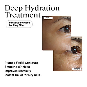 MATKAS Korean Triple Pure Hyaluronic Acid Serum for Face + 2% Niacinamide B3 + Vitamin B5 + 8 Peptides for Deep Firming, Plump Wrinkles, Hydrating Dewy Skin, Anti Aging Acido Hialuronico Facial Serum