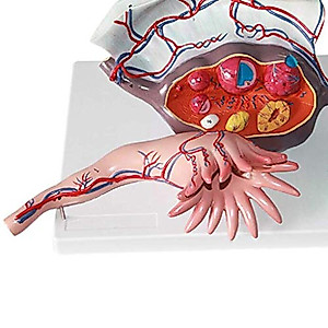 DEAVER Uterine Anatomy Model Ovarian Enlargement Model Skin and Genitourinary System Anatomical Medical Educational Training Aid,Medical Models & Educational Materials