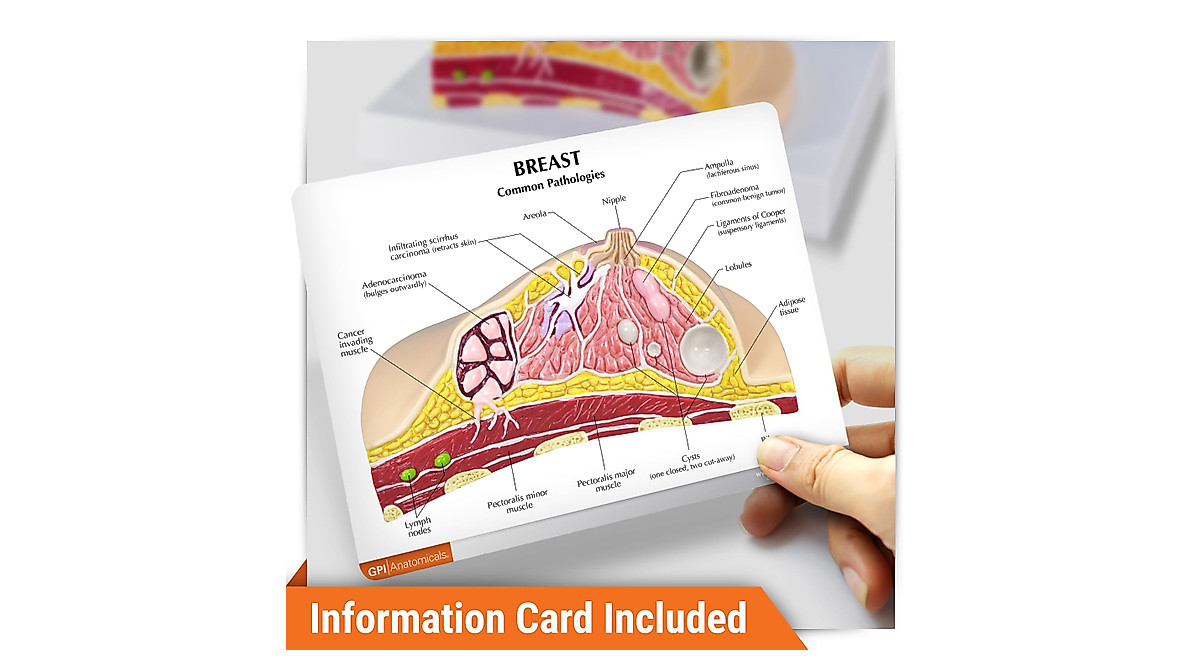 Breast Cross-Section Model | Accurate Breast Anatomy for Education